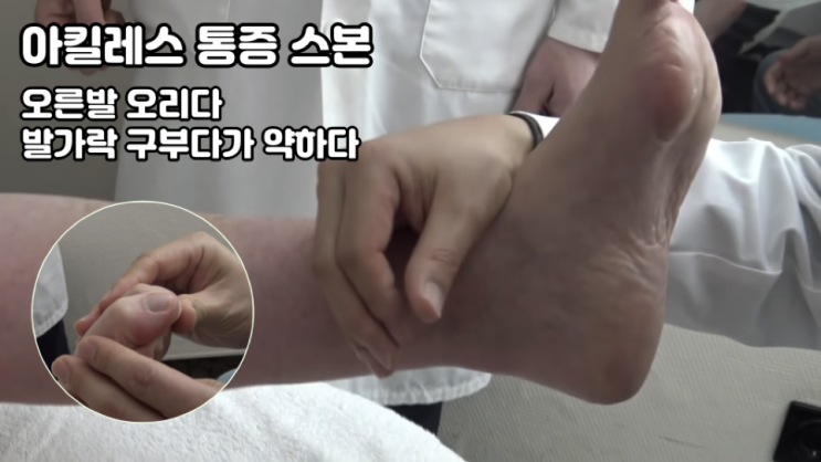 432. 20년 아킬레스 통증 KSNS KSS 한 번 스본 스도로 80% 개선 : 네이버 블로그