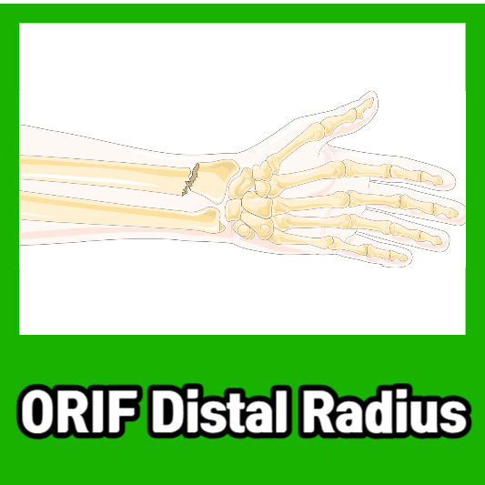 ORIF Distal Radius Fracture 수술 개방정복내부고정술 : 네이버 블로그