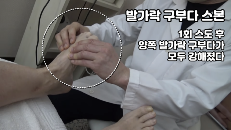 437. 40년 허리 통증 KSNS KSS 한 번 스도본 후 100% 개선 : 네이버 블로그