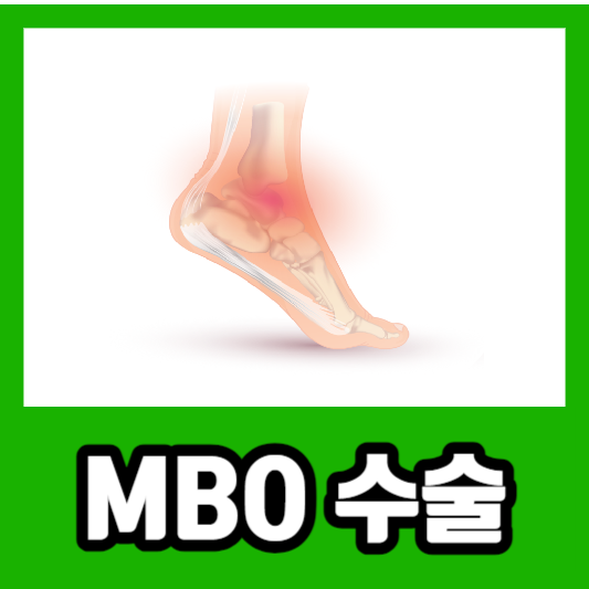 MBO 수술 Modified Brostrom Operation 수술준비 및 과정 : 네이버 블로그
