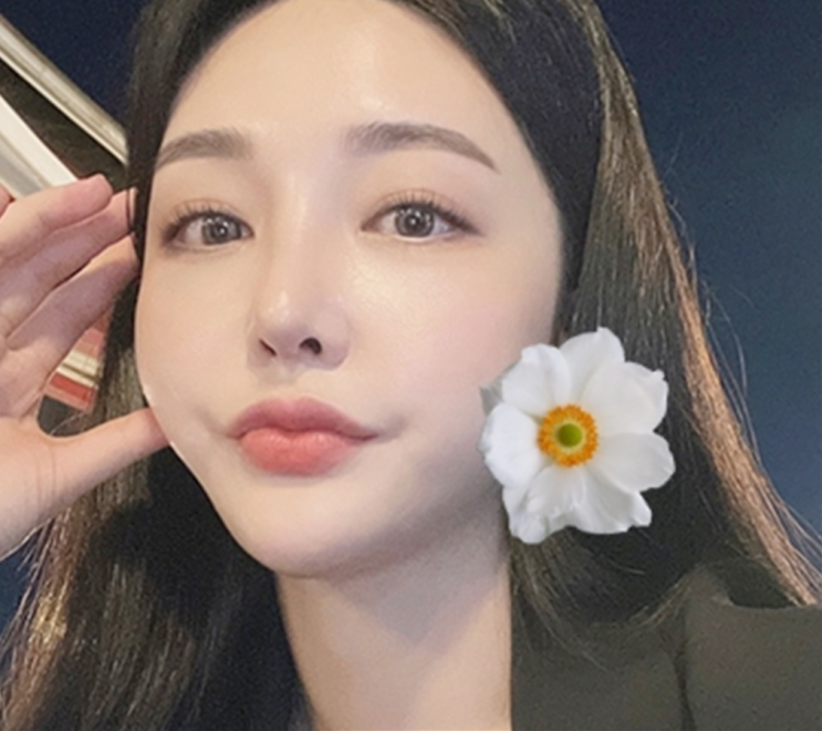 비염 수술 후기 공유 휘어진코 휜코 교정비용 실비보험 N일차 휜코 교정 수술후기 네이버 블로그