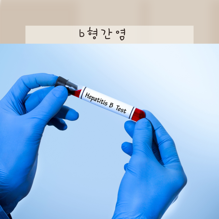 B형간염 증상 항원 항체 검사 비용 양성 전염 보균자 치료제 완치제 비형간염 성인 예방접종 주사 살펴보자 네이버 블로그