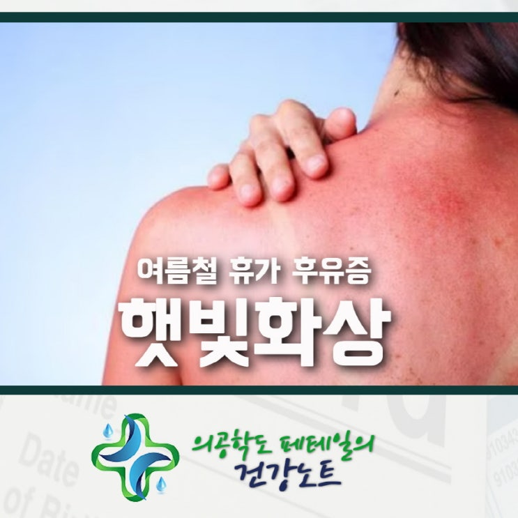여름철 물놀이 후 생기는 햇빛화상일광화상 원인과 증상 치료방법은 네이버 블로그