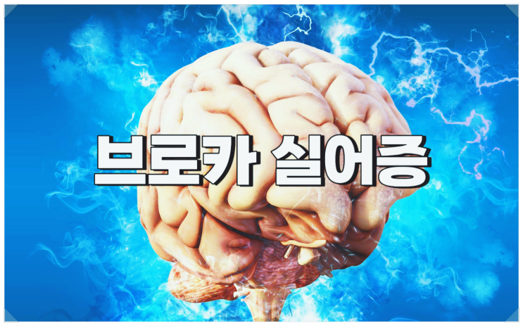대구 실어증 언어치료 동대구아동발달센터 부설 언어학습연구소 네이버 블로그