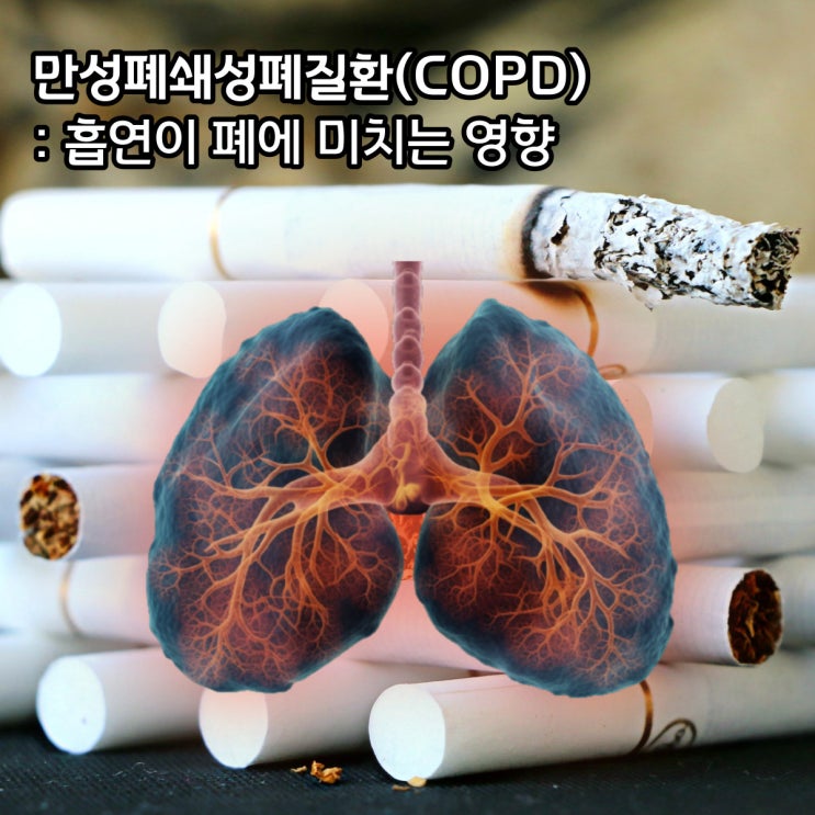 만성 폐쇄성 폐질환 증상(COPD) 및 원인, 치료방법은? : 네이버 블로그