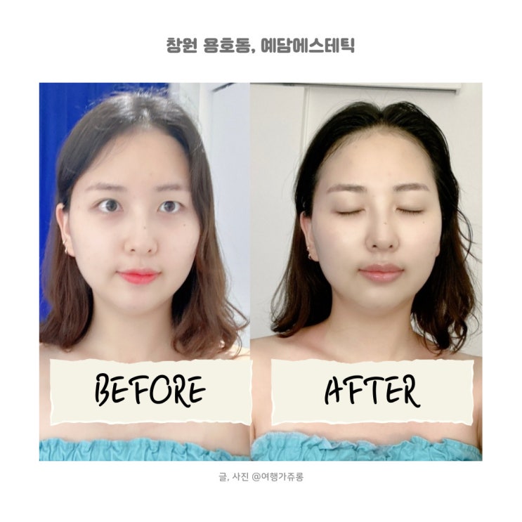 창원에스테틱 웨딩관리준비는 창원피부관리 예담에스테틱 네이버 블로그