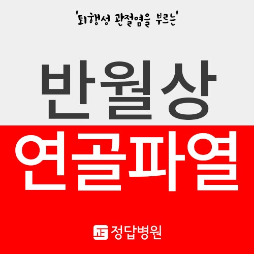 수원무릎통증 퇴행성 관절염을 부르는 반월상연골파열 원인과 증상 치료방법 수원정답병원 네이버 블로그