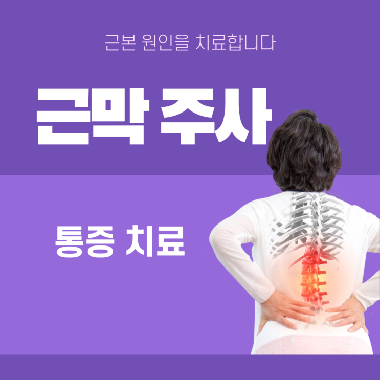 원주 성모병원 원주 근막 주사 근막통증증후군 통증유발점 주사 림프 도수치료 근육통 체외충격파 정형외과 재활의학과 근육 긴장