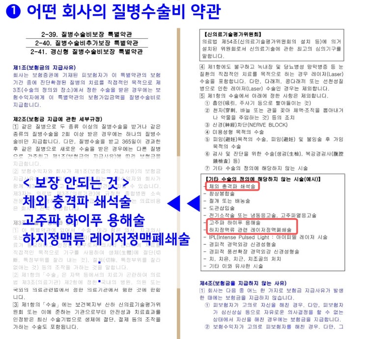 체외충격파쇄석술을 위한 질병수술비와 질병1 5종수술비 보험약관 비교 네이버 블로그