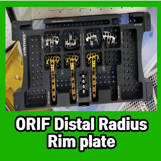 ORIF distal radius rim plate (AO) : 네이버 블로그