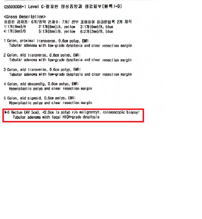 결장의 폴립, 양성신생물 D126, K635 진단을 받으셨을까요?(진단금처리사례) : 네이버 블로그