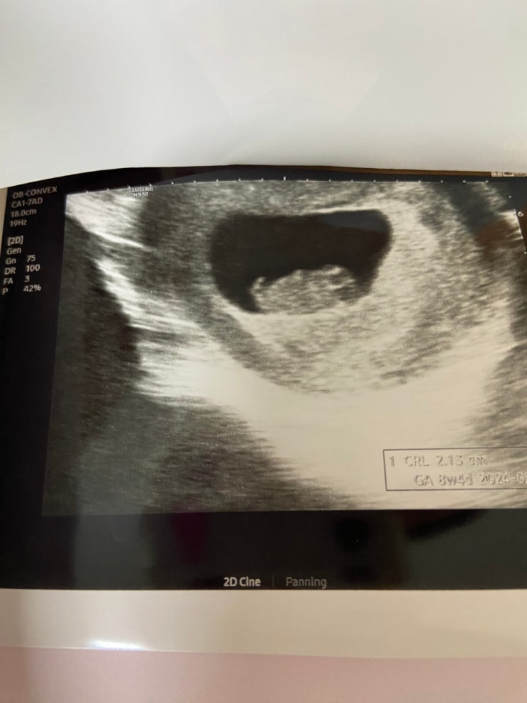 임신일기 ) 임신 7~8주차 임테기진하기. 입덧 먹덧 : 네이버 블로그