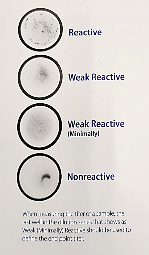 RPR 위양성 원인과 해결방법 : 네이버 블로그