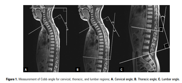 아동 및 청소년의 척추 전만증 Lordosis in Children : 네이버 블로그