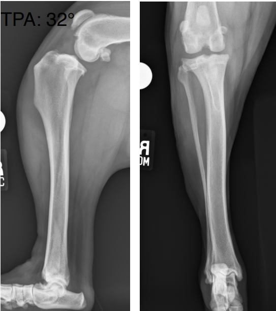 Optimizing Outcomes With Tibial Plateau Leveling Osteotomy : 네이버 블로그