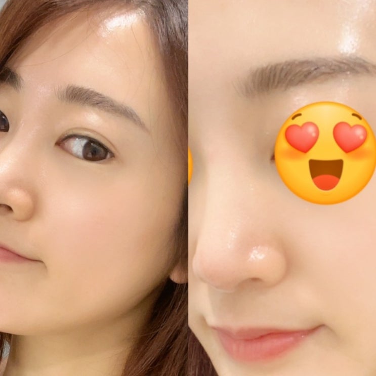 왕십리 피부관리 물방울리프팅 수분과 미백 채워 네이버 블로그