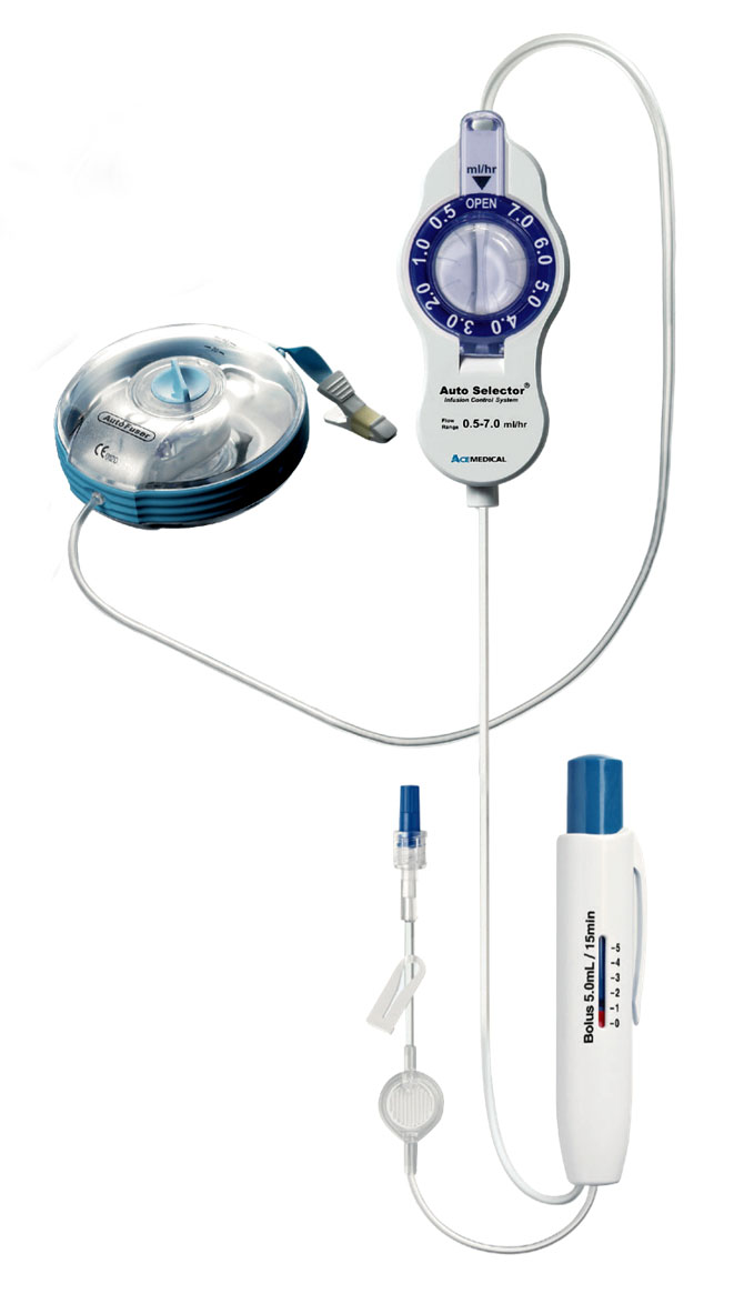 자가조절진통펌프(patient controlled analgesic pump) - PCA : 네이버 블로그