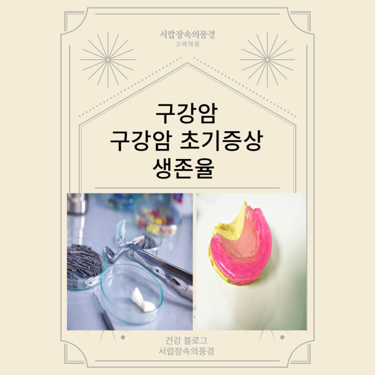 구강암 치명적인 구강암 초기 증상 구강암 증상 구강암 종류 생존율 네이버 블로그