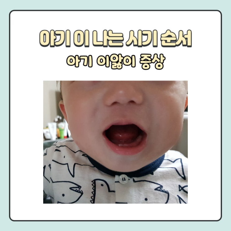 아기 이나는 시기 이앓이 증상 및 유치 빠지는 순서 시기 네이버 블로그