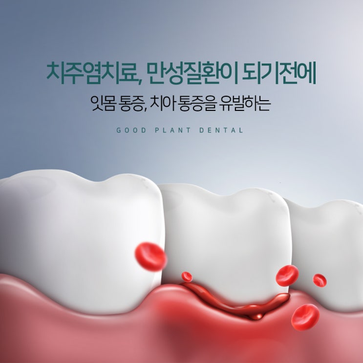만성질환이 되기 전에 창원치주염 치료 이루어져야 네이버 블로그
