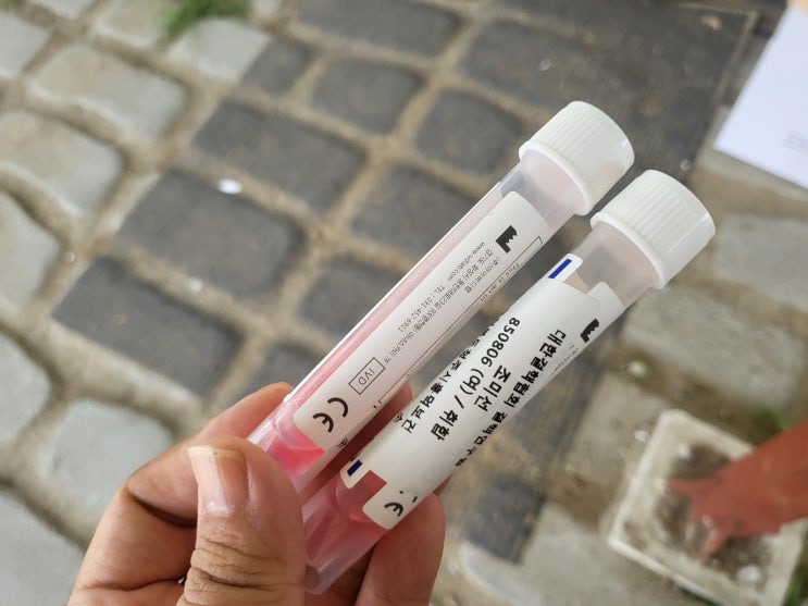 청주 코로나 보건소 Pcr 검사 신속항원검사 비용 결과 8월 주말 공휴일 보건소 선별진료소 운영시간 W입원 네이버 블로그