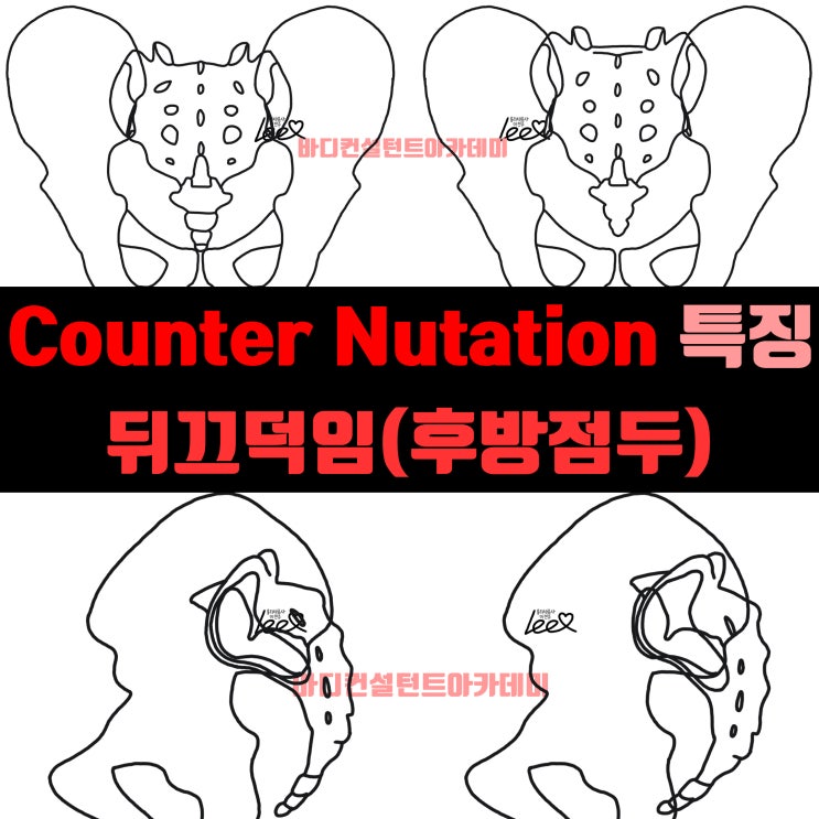 뒤끄덕임(후방점두, Counter Nutation)의 특징 : 네이버 블로그