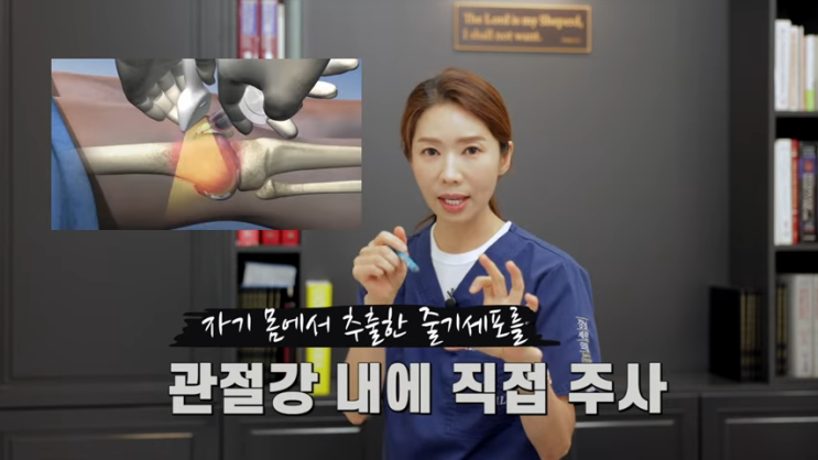 무릎통증 인공관절수술카티스템줄기세포주사 뭐가 좋을까 네이버 블로그