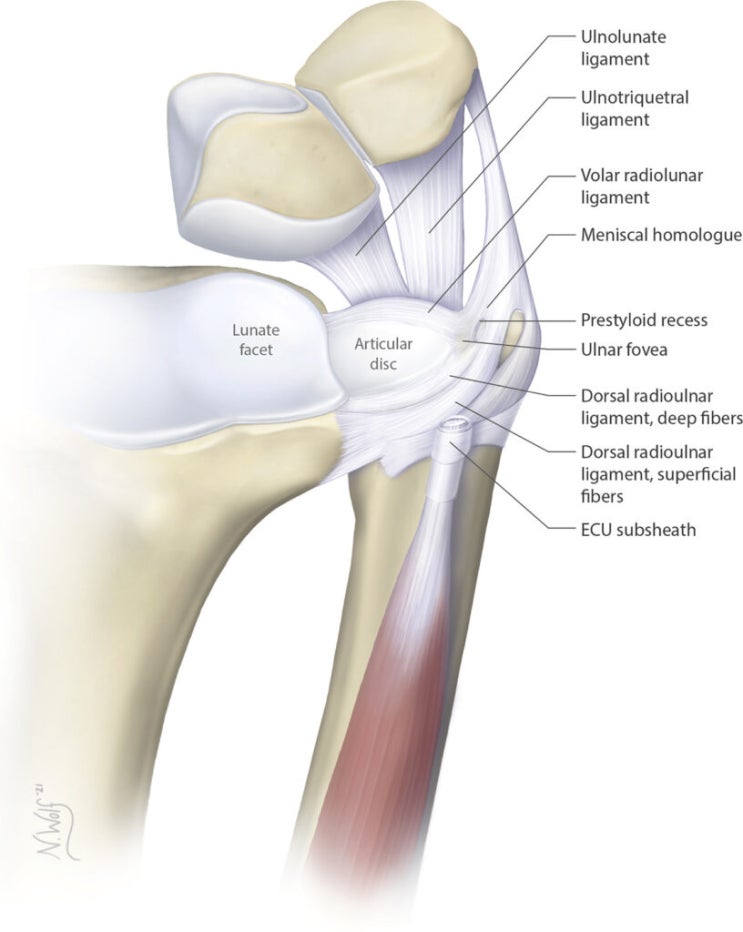 [손목]wrist FCU - calcific tendinitis : 네이버 블로그