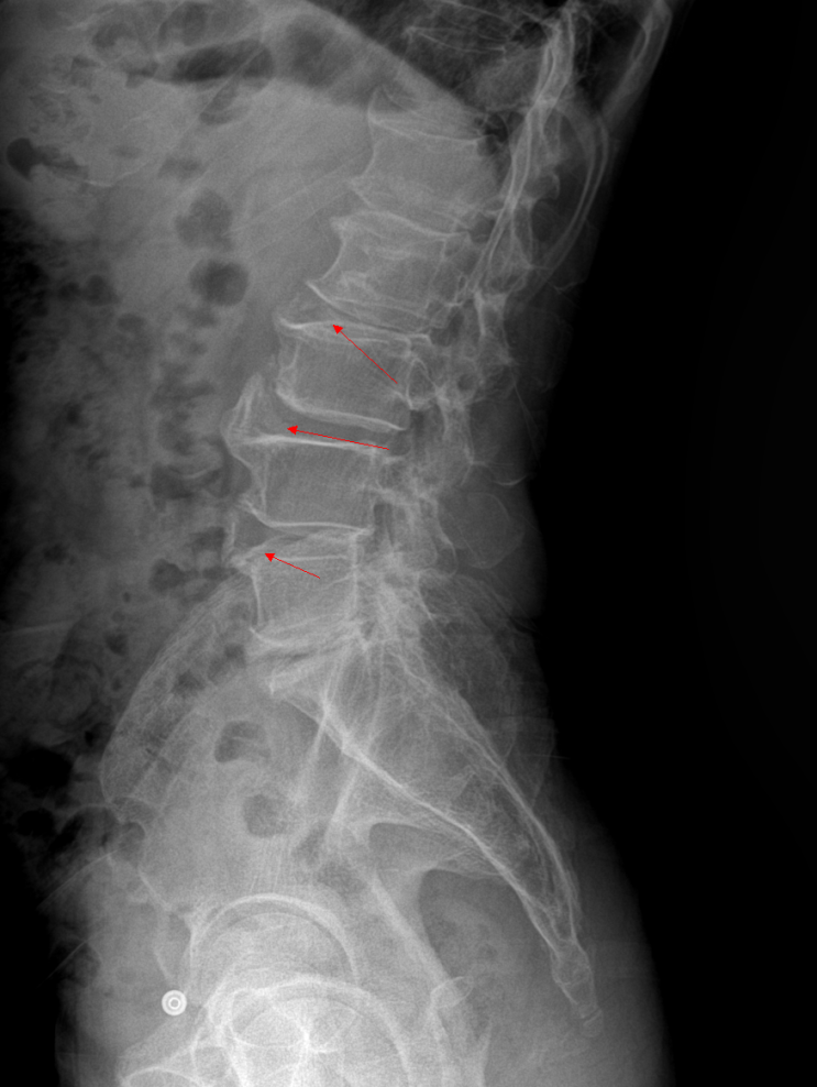 안 아프기 위한 필수 3가지 : 네이버 블로그