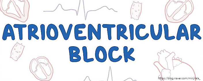 방실차단 AV block, atrioventricular block 종류 심전도 검사 치료 (+complete block ...
