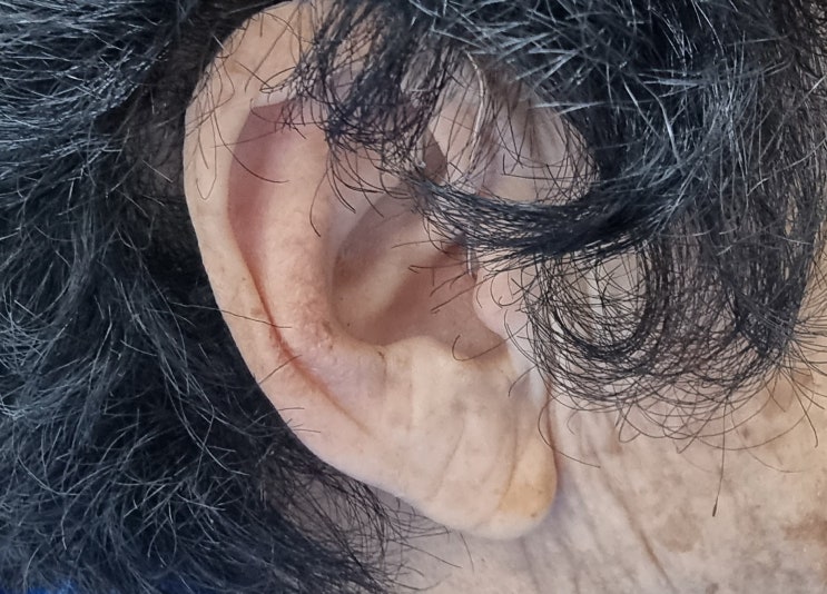밀양보청기밀양독일보청기밀양시그니아독일보청기공식인정 전문센터~ 동네분의 소개를 받고 저희 센터를 방문하신 어머님
