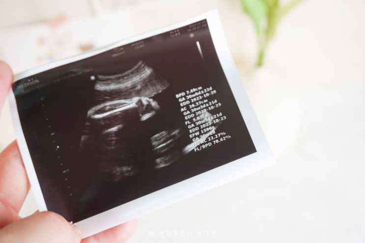 임신 주수별 태아크기 몸무게 표 정리 네이버 블로그