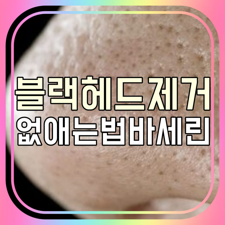 코 블랙헤드 제거 없애는 법 및 관리 방법 바세린 괜찮을까 네이버 블로그