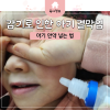 감기로 인한 급성 결막염 어린이집아기 안약넣는법 회복기 네이버 블로그