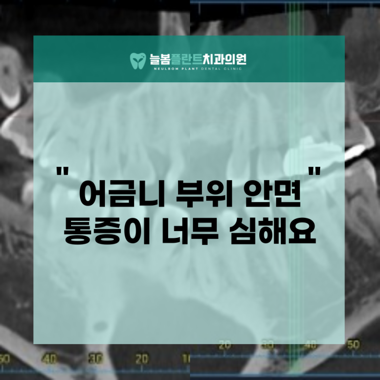 반월당역치과 상악동염 원인과 증상 및 치료사례 네이버 블로그