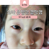 아기 눈곱이 심할때 전염성이 강한 소아 유행성 결막염 네이버 블로그