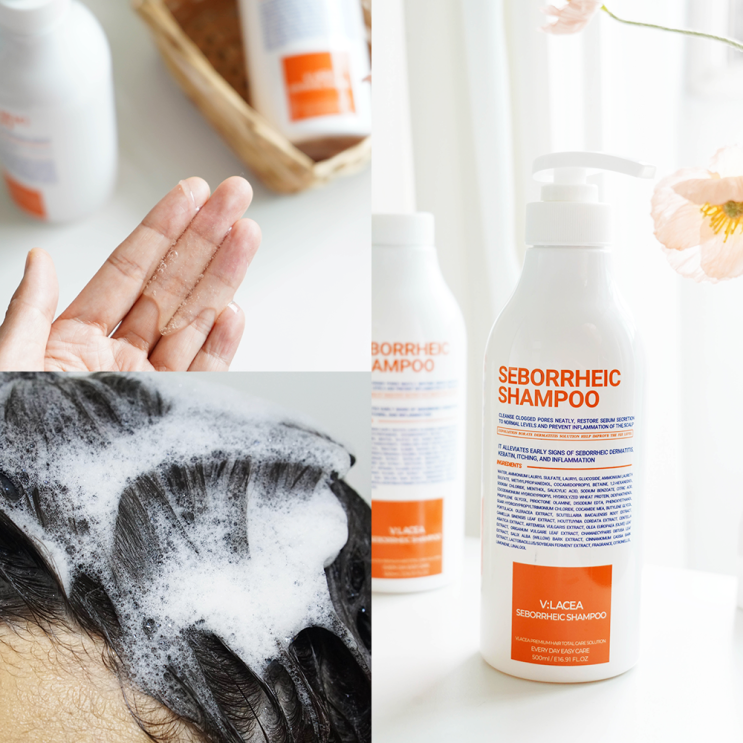 비듬샴푸 추천 지루성 두피관리 블라세아 세보리아 : 네이버 블로그