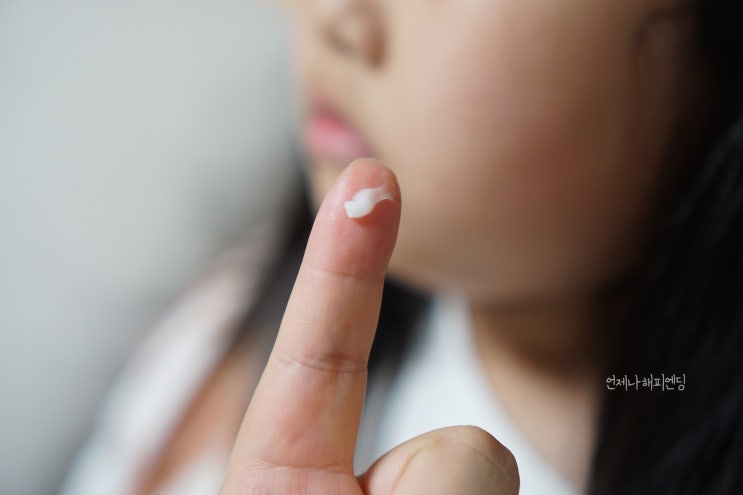 아기침독크림 하나로 아기얼굴침독 케어 네이버 블로그