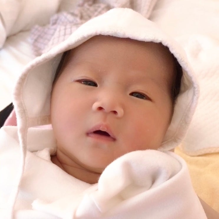 신생아 쌍꺼풀 라인 눈크기 변화 아기 눈붓기 쌍꺼풀 언제 자리잡을까 네이버 블로그