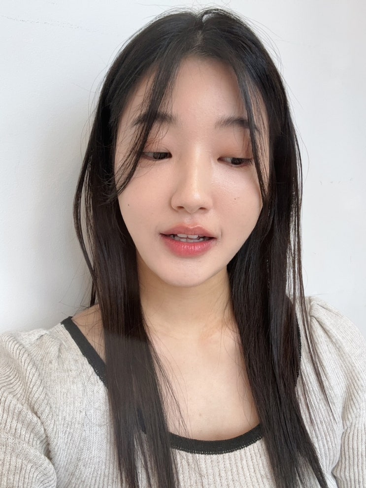라운딩으로 생긴 기미 잡티 박멸 공덕역피부과 피코토닝효과 2회차 30일 뒤 변화리뷰 네이버 블로그