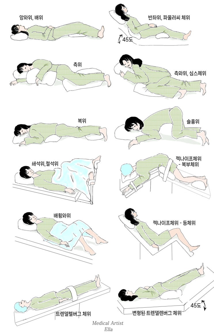 체위 종류 앙와위 반좌위 슬흉위 배횡와위 쇄석위 : 네이버 블로그