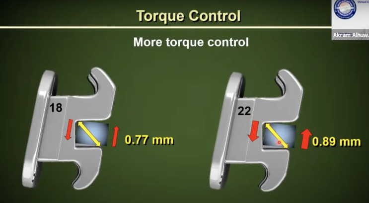 브라켓 토크 조절 (bracket torque control) : 네이버 블로그