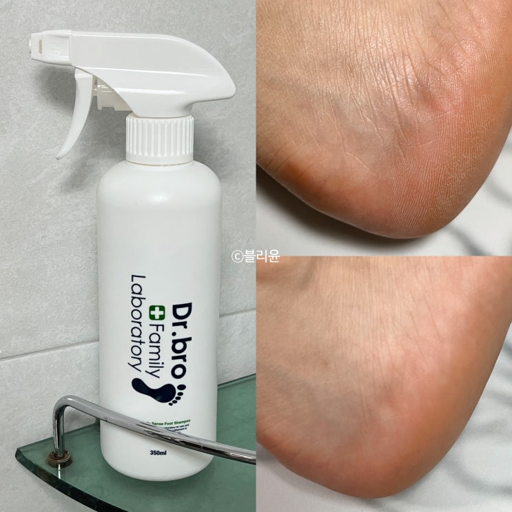 풋필링 발냄새 스프레이로 발각질제거제없이 발관리하는 닥터브로 풋샴푸 네이버 블로그