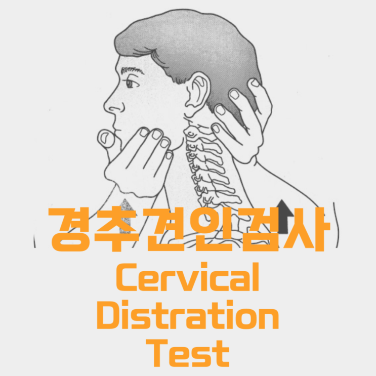 경추견인검사,cervical distraction test 방법 : 네이버 블로그