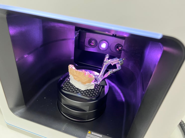 우리 치과를 소개합니다. 우치소 9편, 디오에프연구소 스캐너(DOF LAB SCANNER) : 네이버 블로그