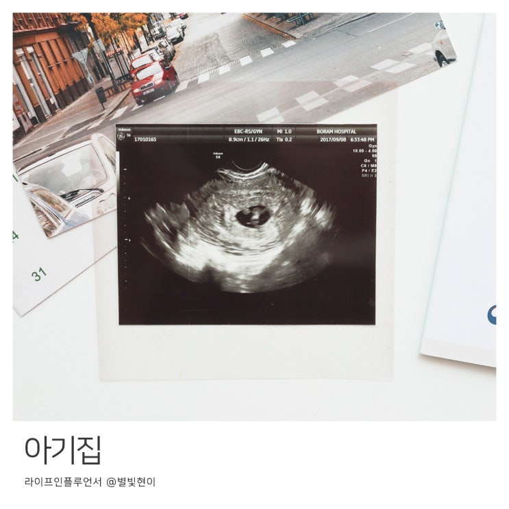 임신 난황 아기집태낭 보이는 시기 임산부카드 임신바우처 신청 방법 네이버 블로그