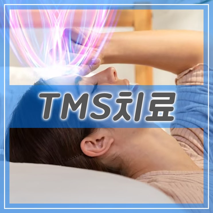 Tms 치료 경두개자기자극술 Tms치료의 장점과 단점 부작용 문제까지 네이버 블로그