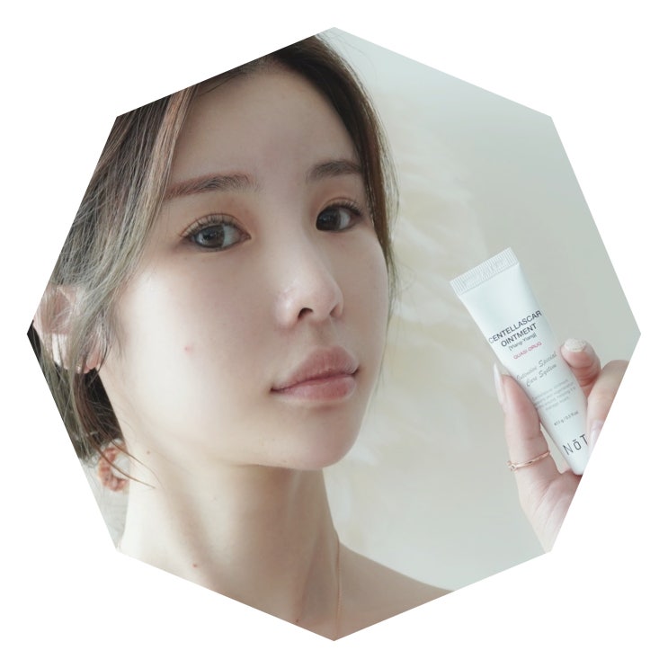화농성 여드름 연고 낫츠 센텔라스카 연고 N통째 네이버 블로그