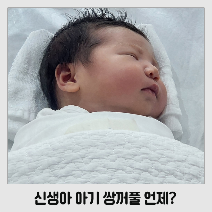 신생아 아기 쌍꺼풀 언제 아기 눈붓기 쌍꺼풀 유전 확률 네이버 블로그
