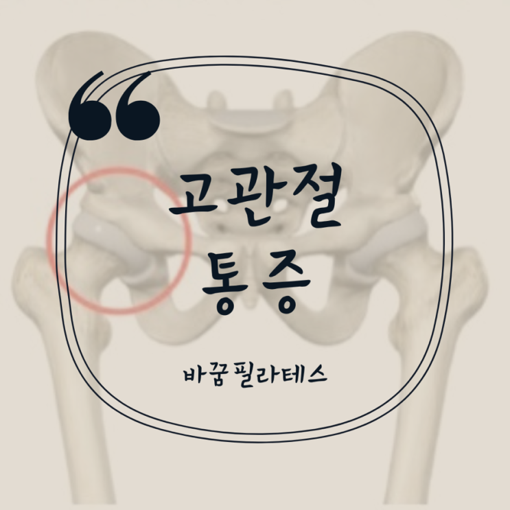 고관절 통증 골반 불균형 골반 교정 창원 성산구 필라테스 남양동 필라테스 바꿈필라테스 네이버 블로그